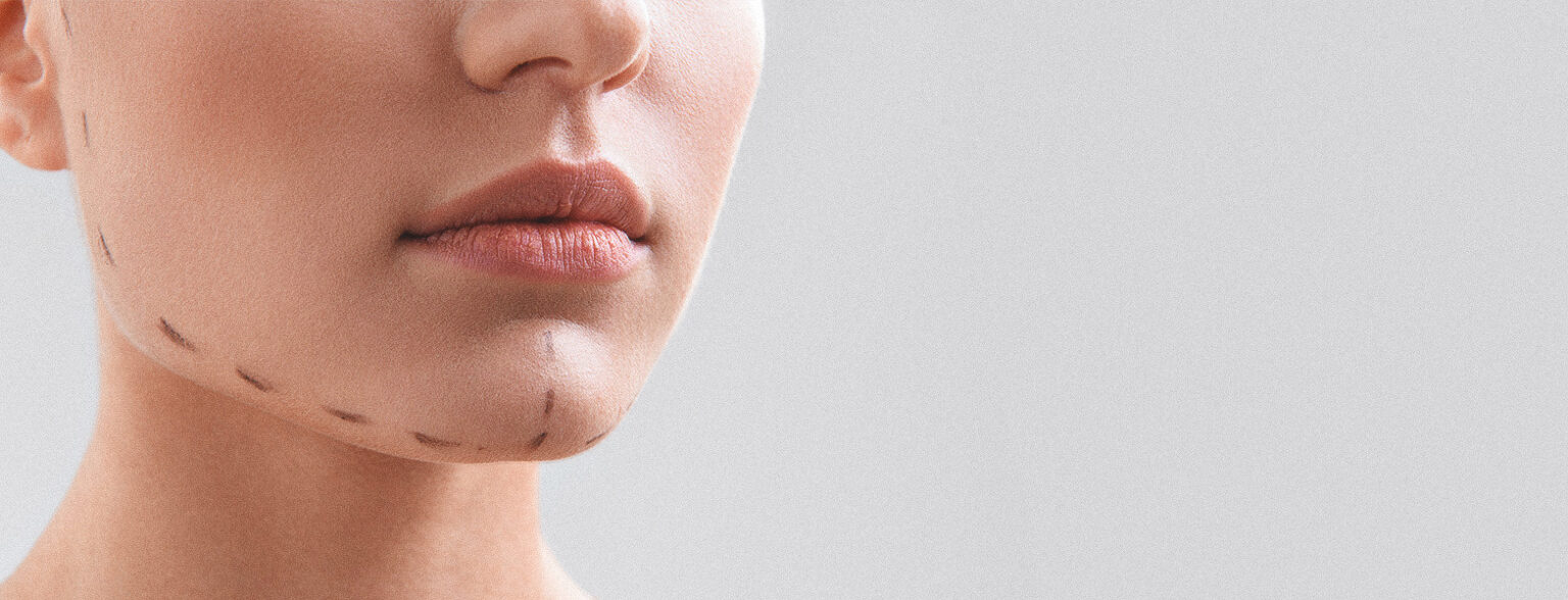 What Is Long Chin Surgery? - Enhancing Your Profile